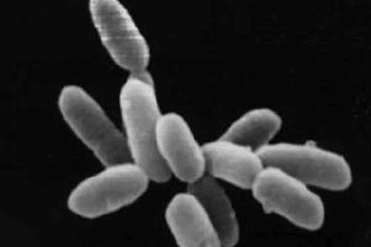 Archées ou Archaea : définition, exemples et différence avec les bactéries